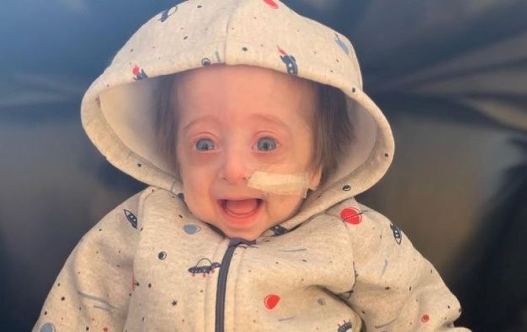 La impresionante historia de Vito: nació con el síndrome de "Benjamin ...