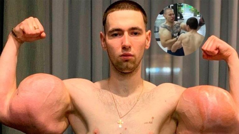 ¡Impactante!: Al Popeye ruso le "explotó" un brazo en pleno combate ...